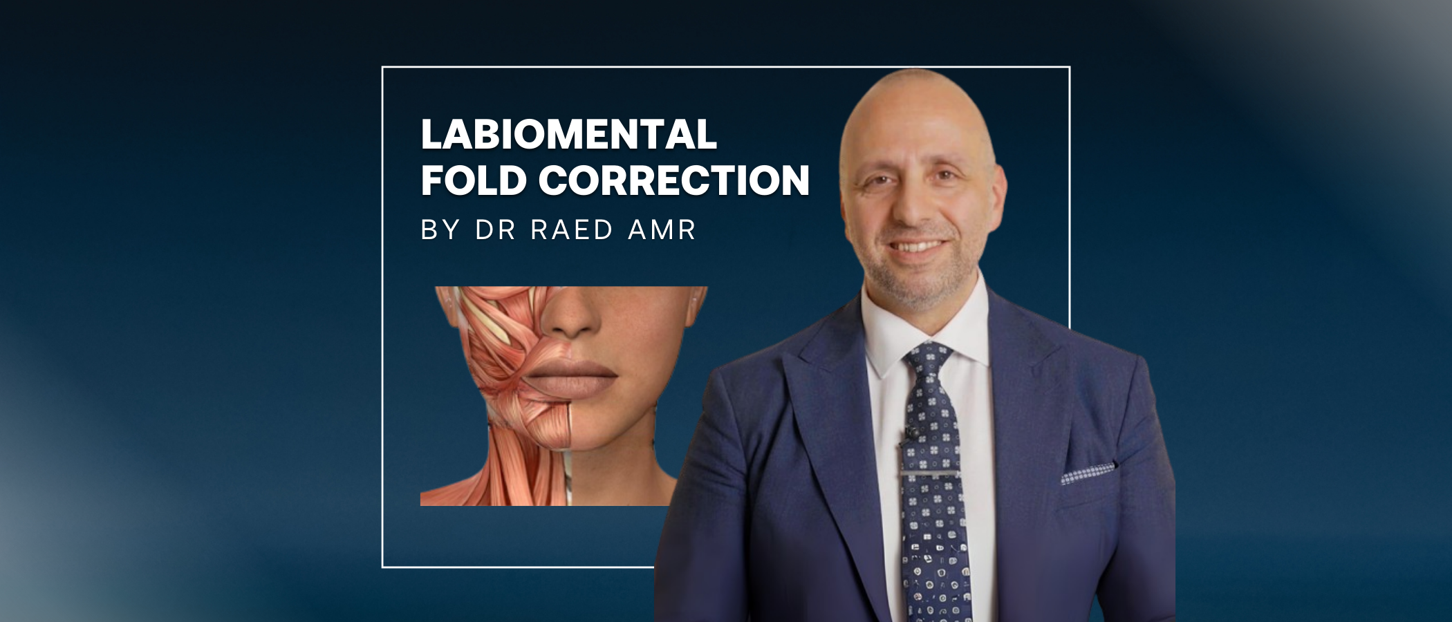 Labiomental Fold Correction: Anatomy, Visual Planning & Precision Marking